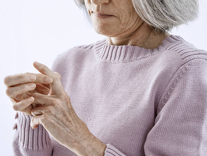 Bouchard-Arthrose der Fingermittelgelenke – Ursache und Behandlung